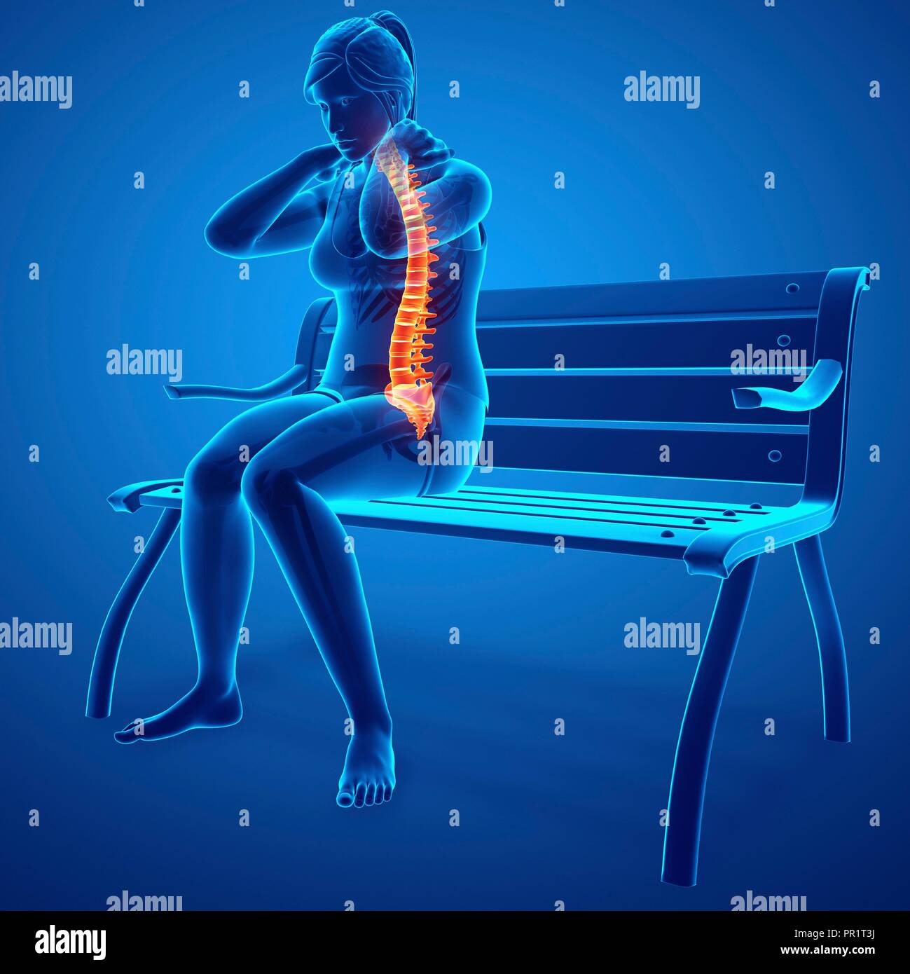 Woman with back pain, computer illustration Stock Photo - Alamy