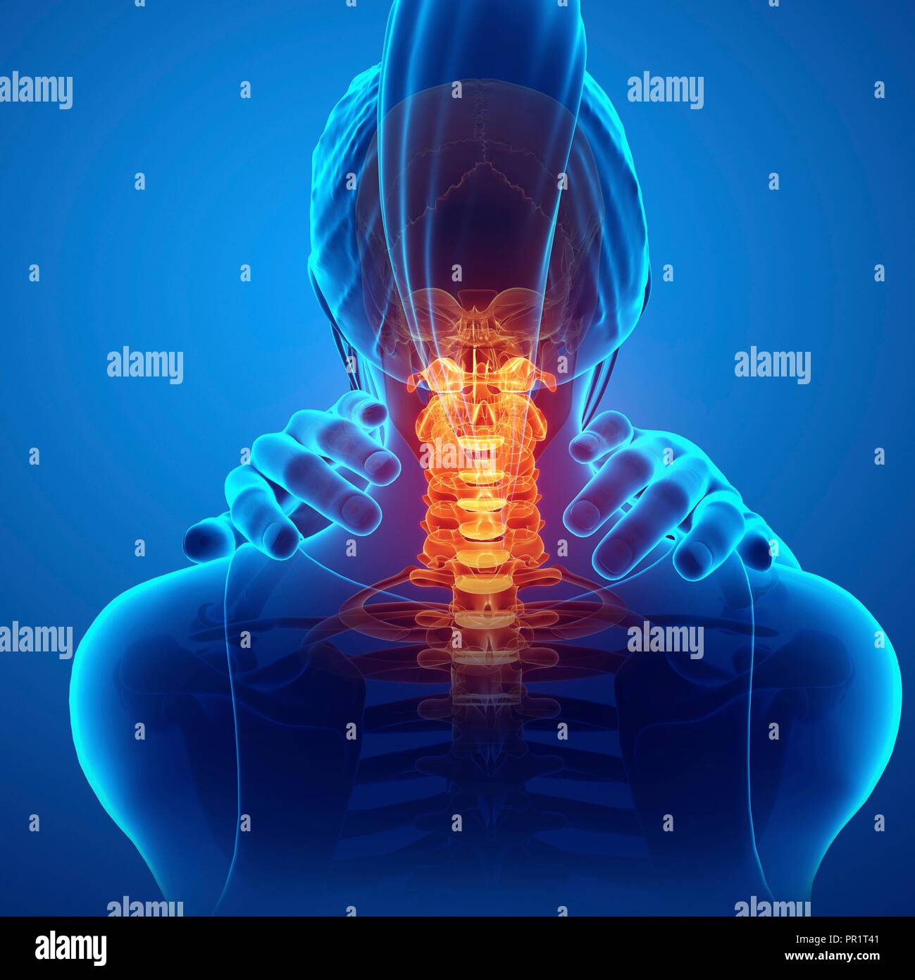 Woman with neck pain, computer illustration Stock Photo - Alamy