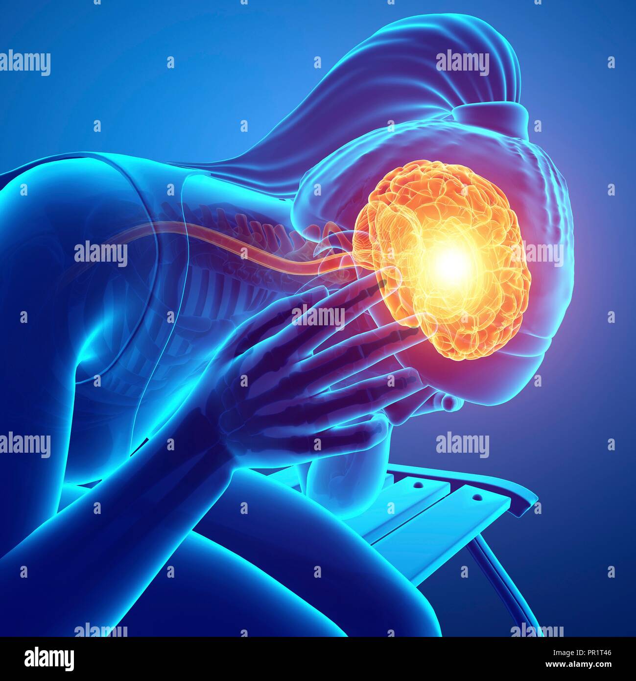 Woman with headache, computer illustration Stock Photo - Alamy
