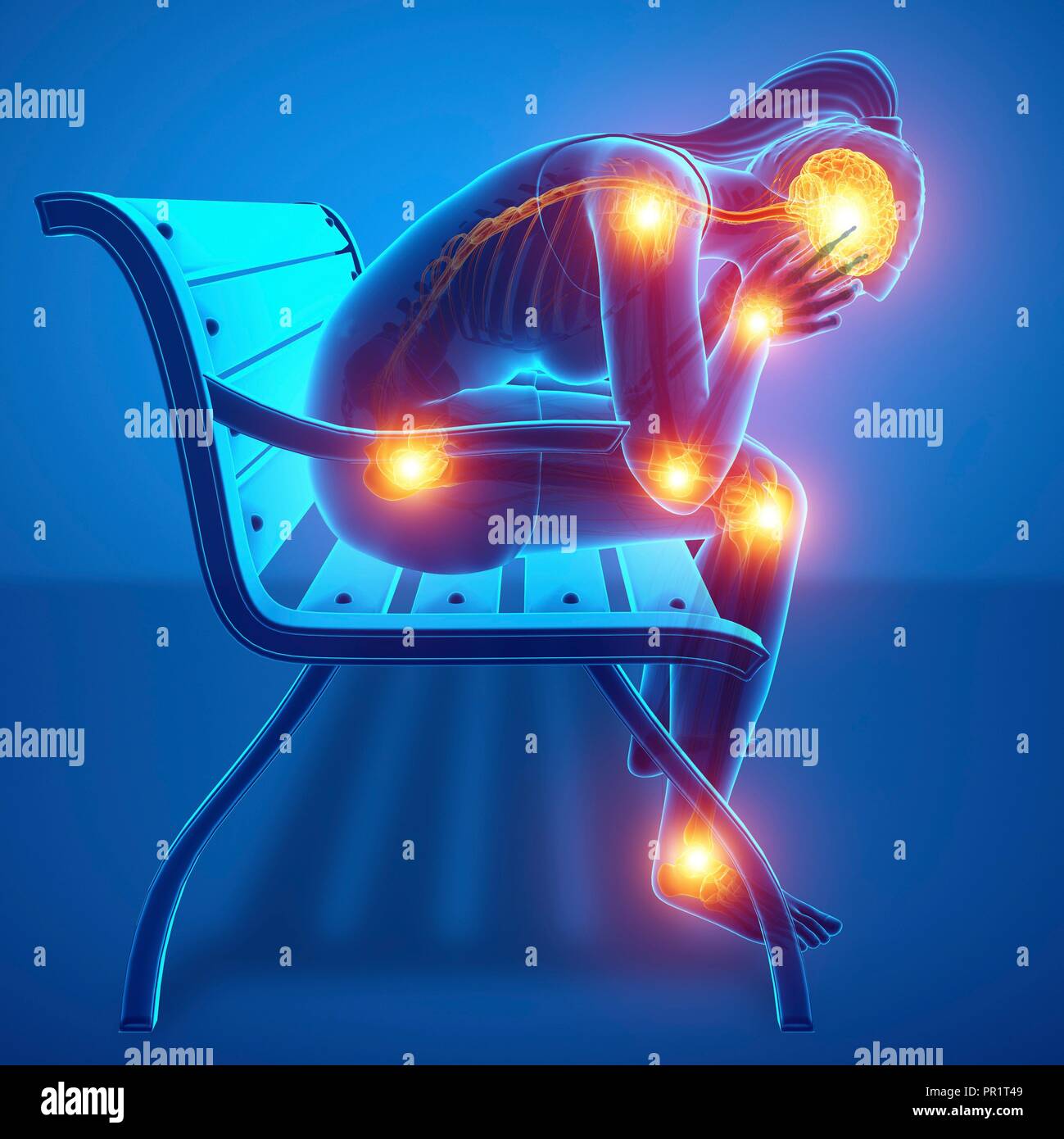 Woman with joint pain, computer illustration Stock Photo - Alamy