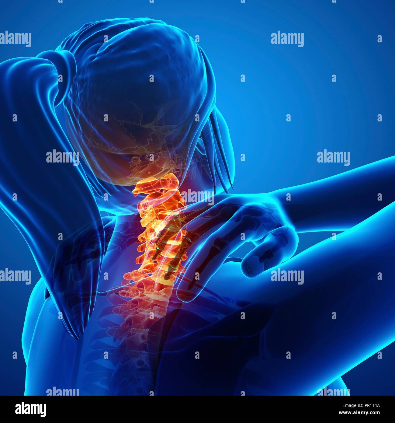 Woman with back pain, computer illustration Stock Photo - Alamy