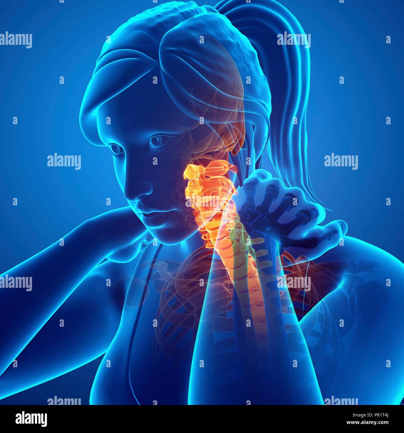 Woman with neck pain, computer illustration Stock Photo - Alamy