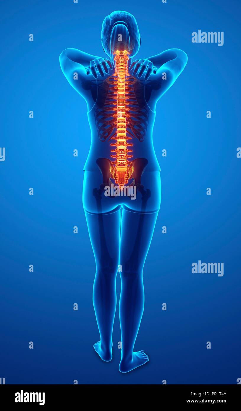 Man with back pain, computer illustration Stock Photo - Alamy