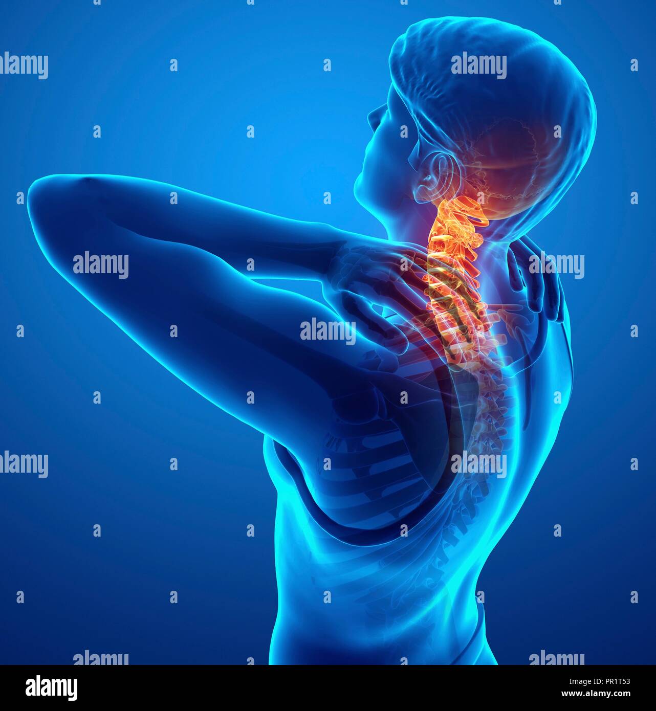 Man with neck pain, computer illustration Stock Photo - Alamy