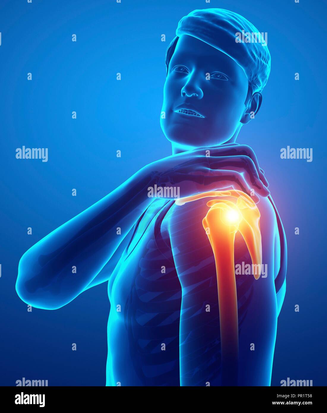 Man with shoulder pain, computer illustration Stock Photo - Alamy