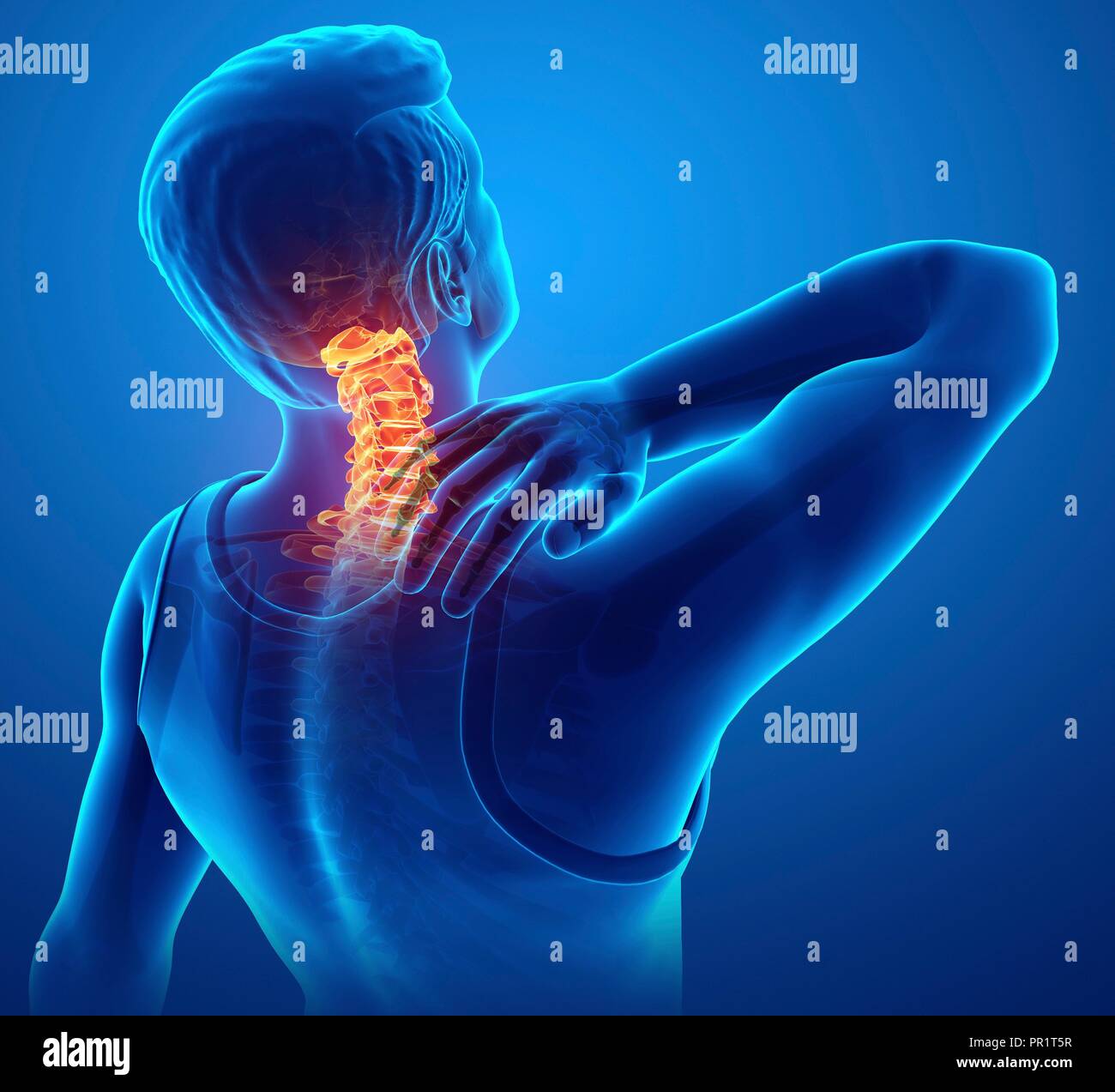 Orthopedic joint pain 3d illustration hi-res stock photography and ...