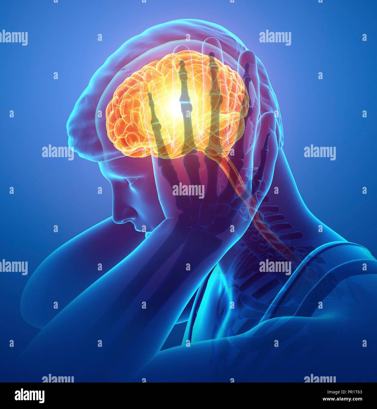 Man with headache, computer illustration Stock Photo - Alamy