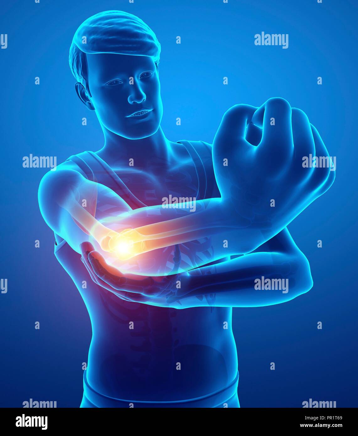 Man with elbow pain, computer illustration Stock Photo - Alamy