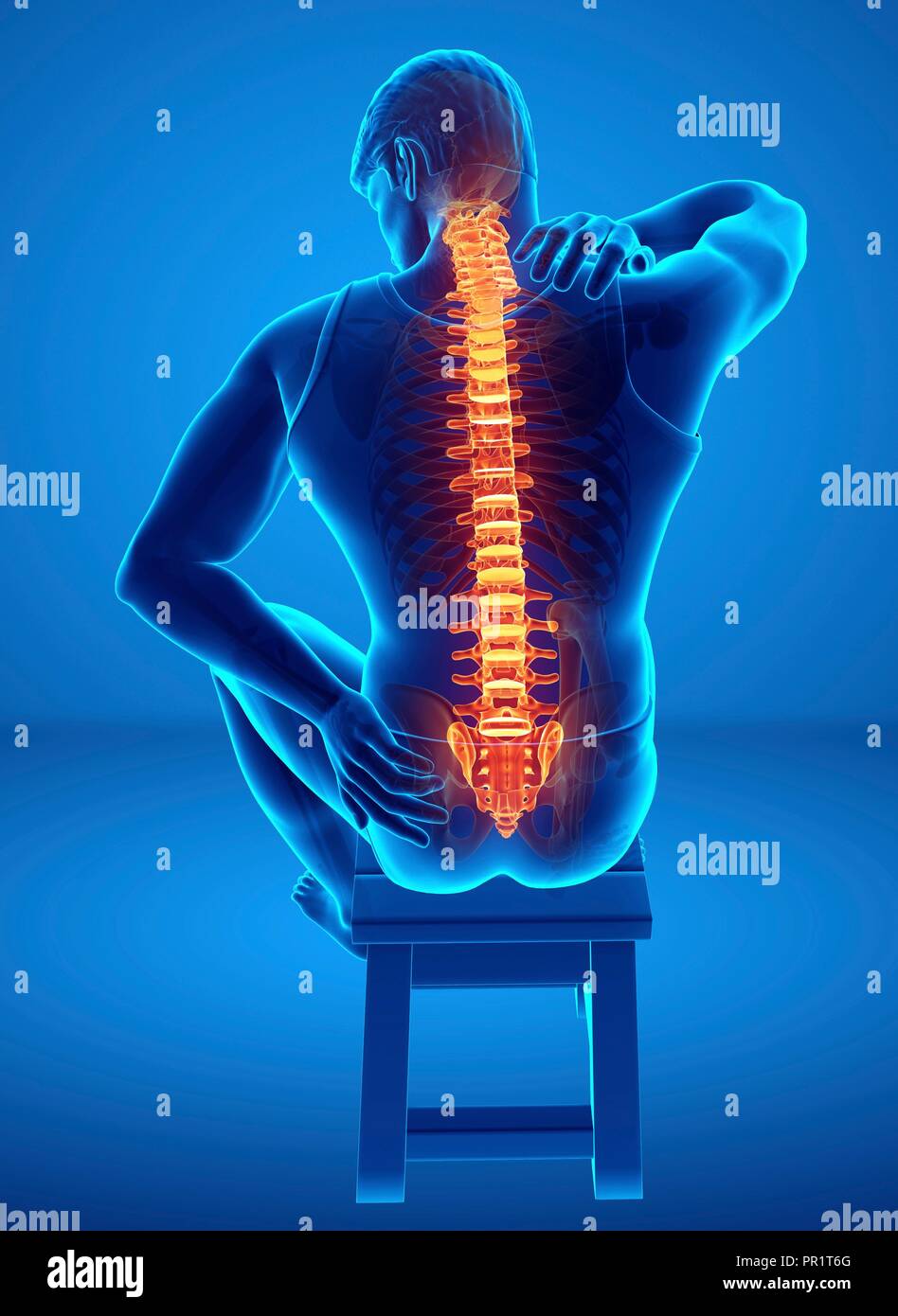Man with back pain, computer illustration Stock Photo - Alamy
