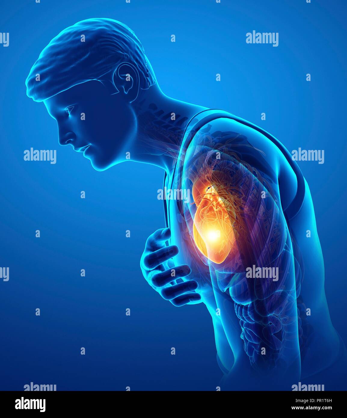 Man with chest pain, computer illustration Stock Photo - Alamy