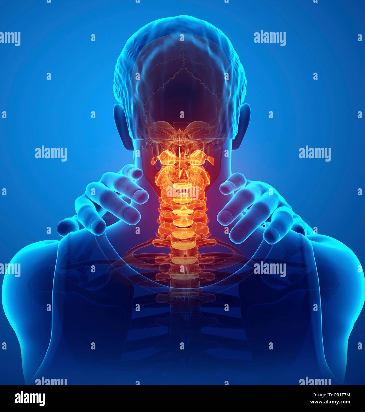 Man with neck pain, computer illustration Stock Photo - Alamy