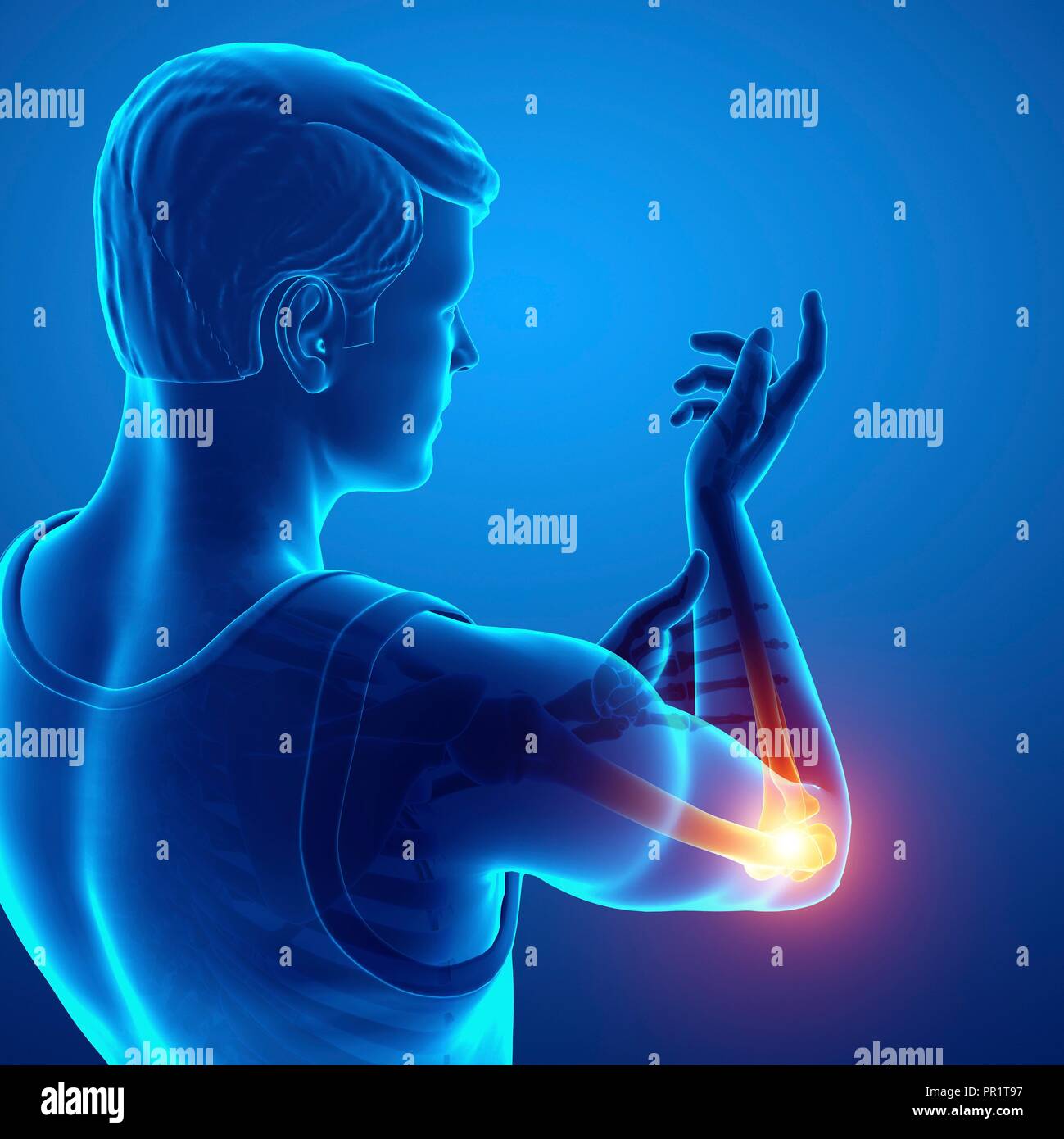 Man with elbow pain, computer illustration Stock Photo - Alamy