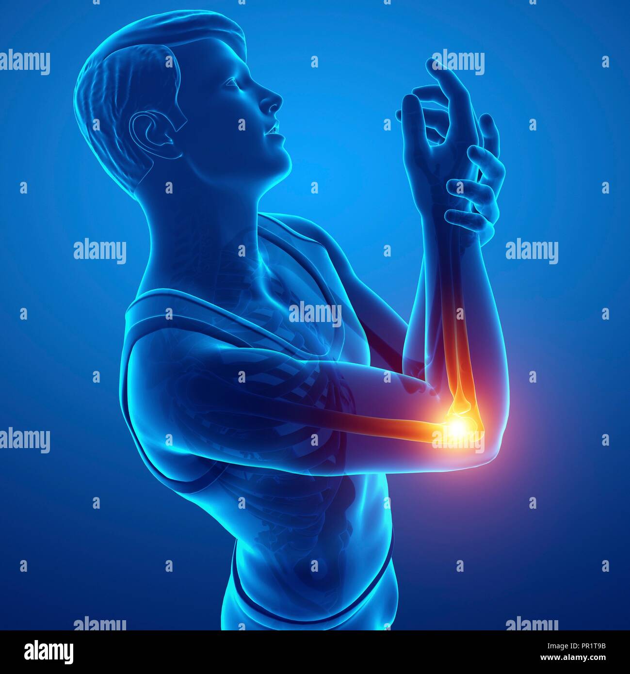 Man with elbow pain, computer illustration Stock Photo - Alamy