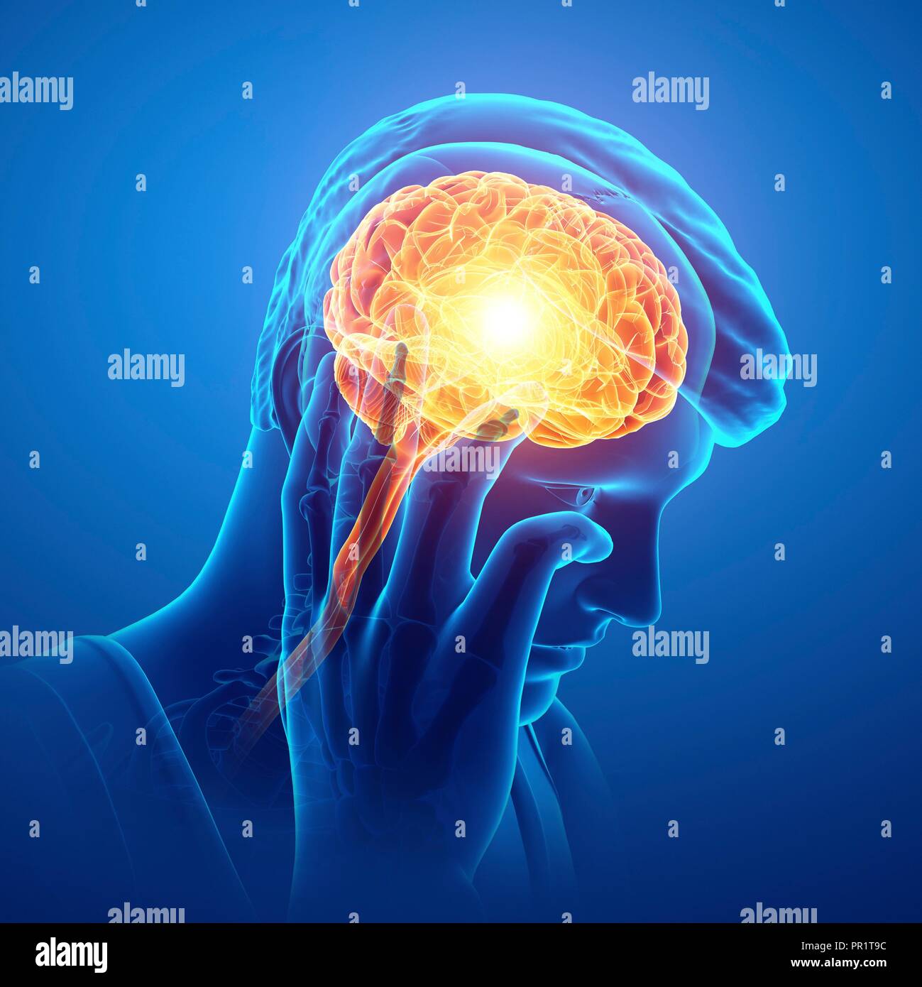 Man with headache, computer illustration Stock Photo - Alamy