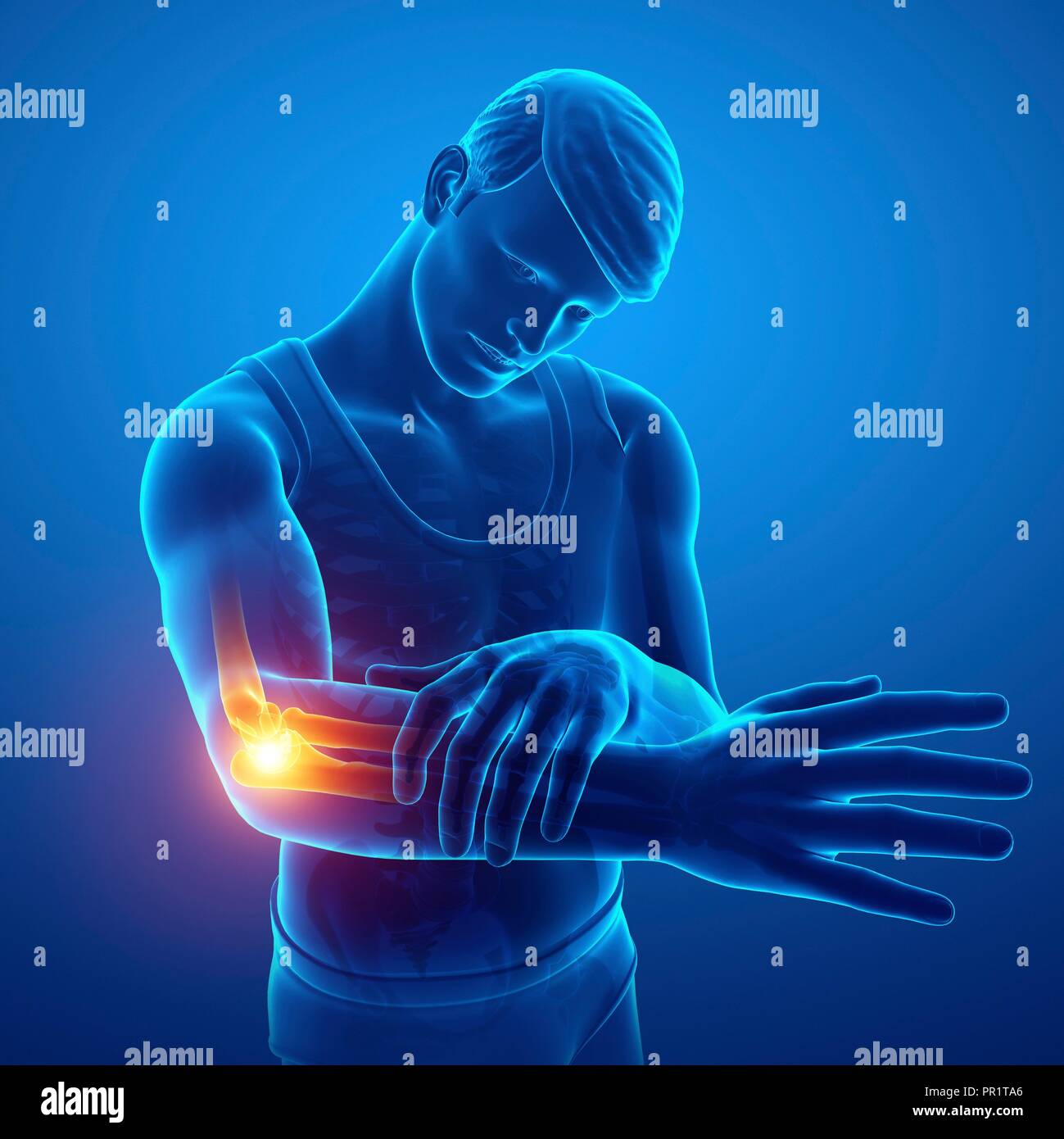 Man with elbow pain, computer illustration Stock Photo - Alamy