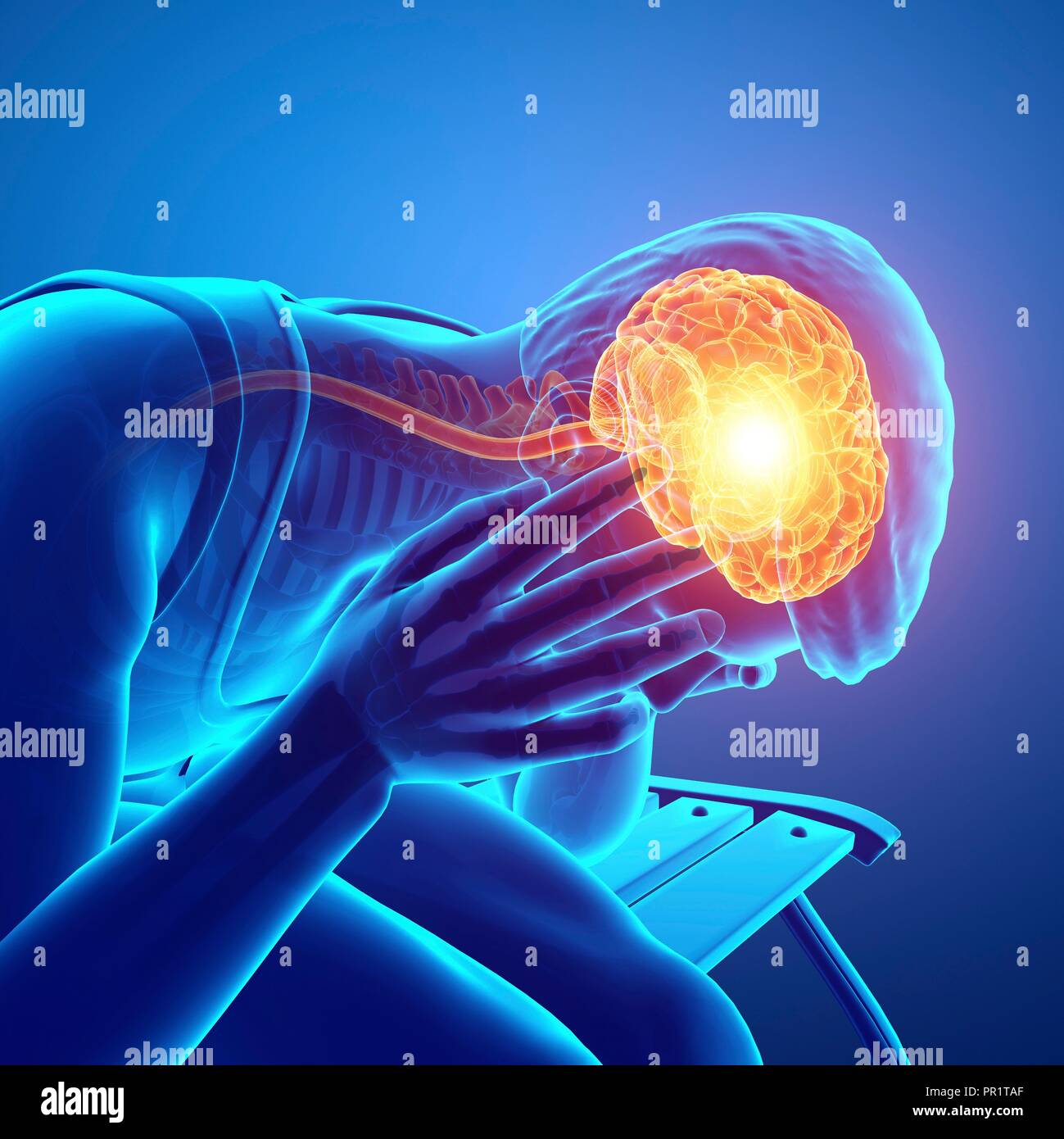 Man with headache, computer illustration Stock Photo - Alamy