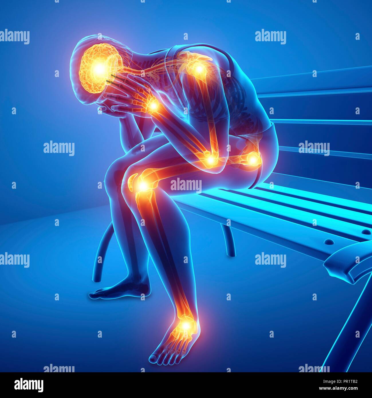 Man with joint pain, computer illustration Stock Photo - Alamy