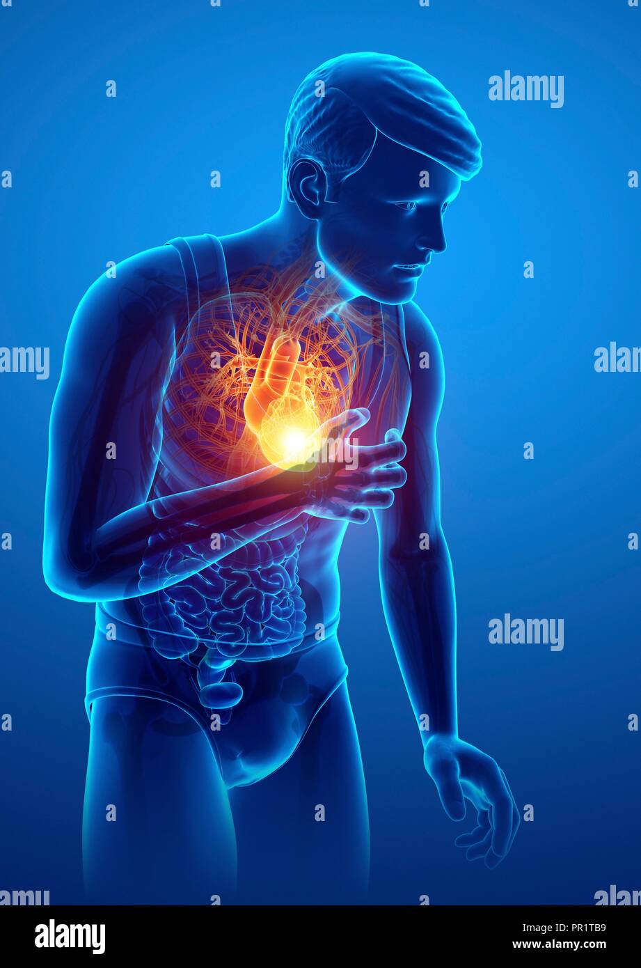 Human heart attack computer artwork hi-res stock photography and images ...