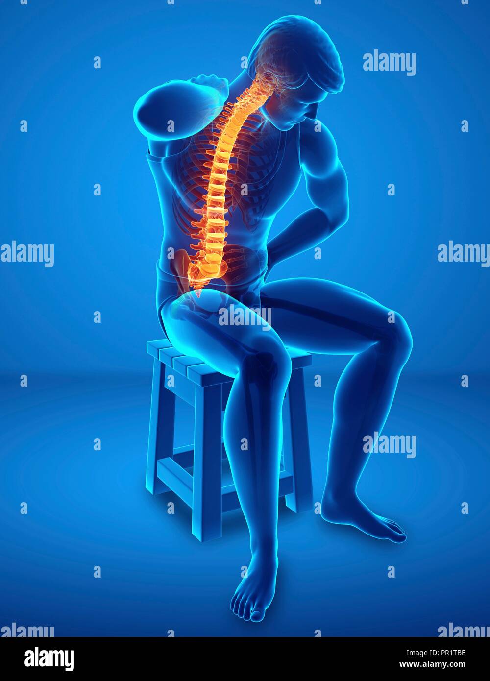 Man with back pain, computer illustration Stock Photo - Alamy
