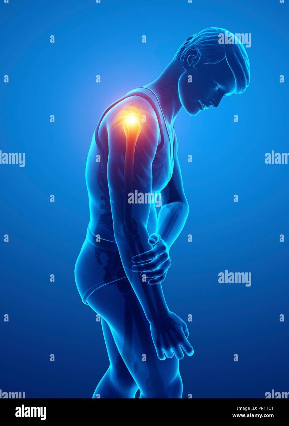 Man with shoulder pain, computer illustration Stock Photo - Alamy