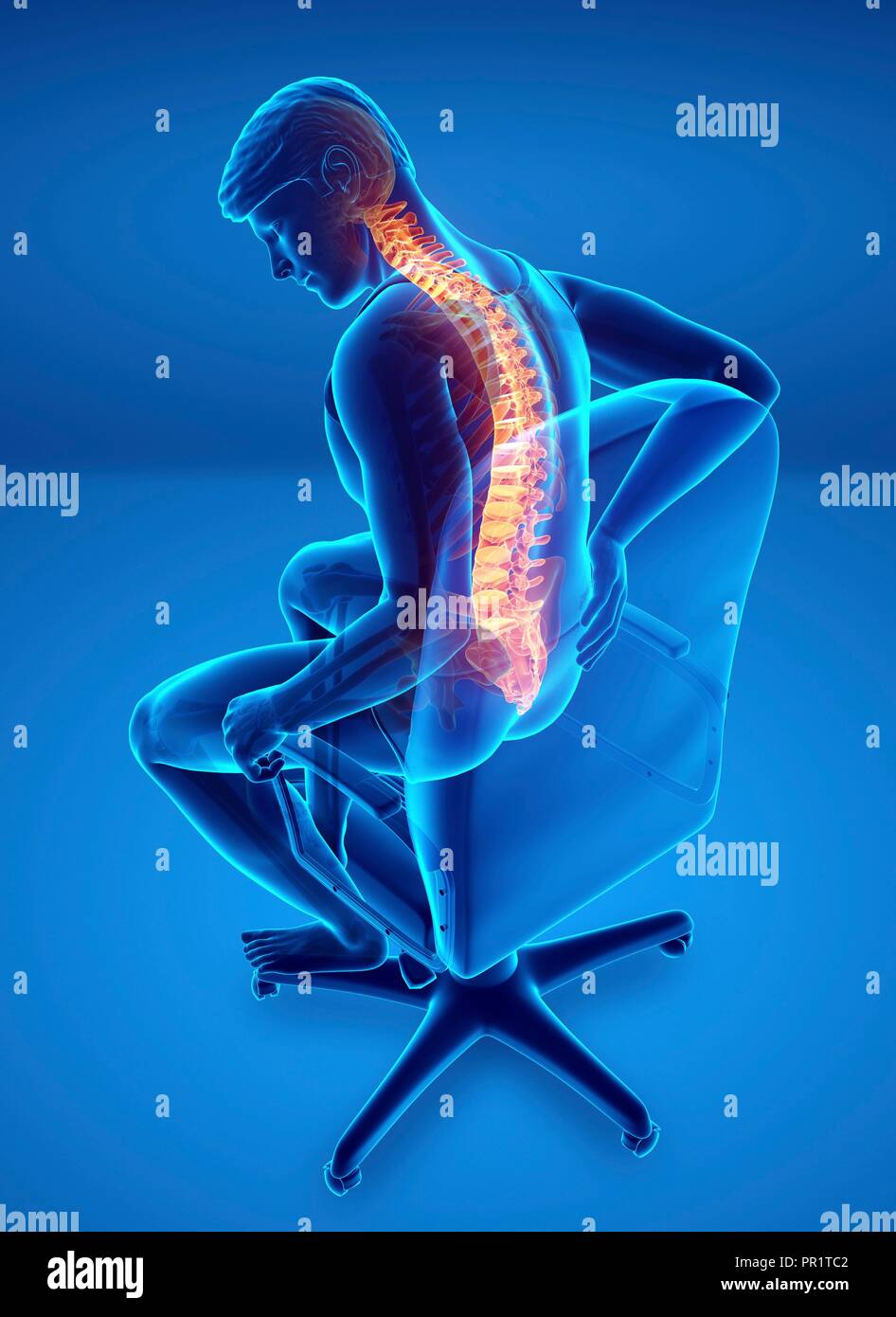 Man with back pain, computer illustration Stock Photo - Alamy