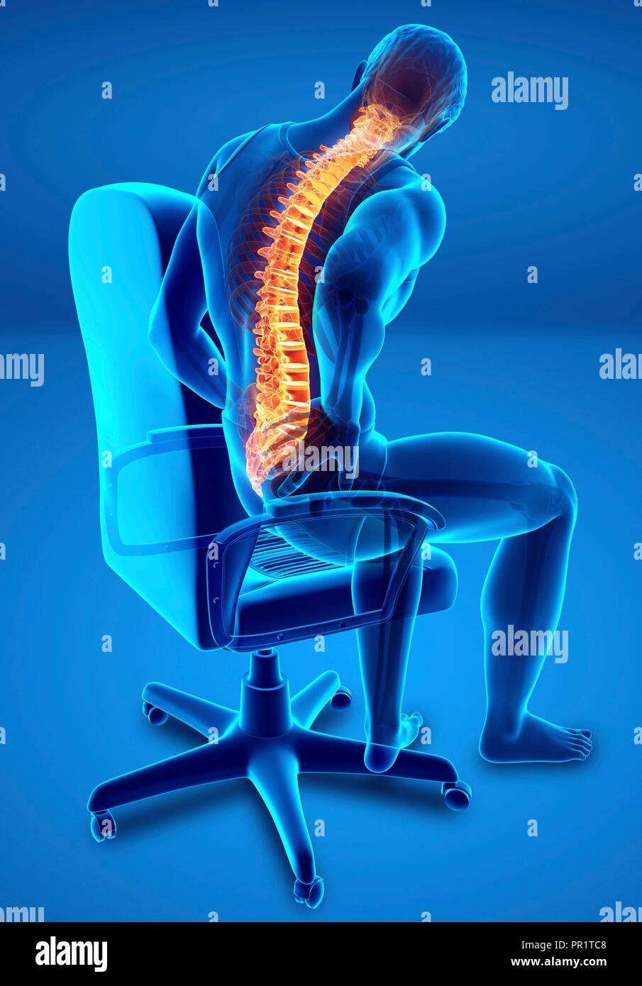 Man with back pain, computer illustration Stock Photo - Alamy