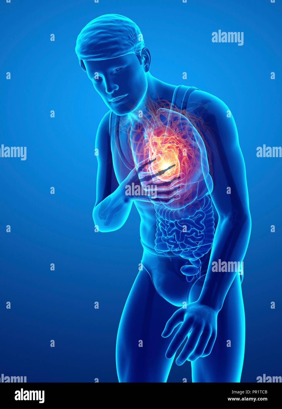 Man with chest pain, computer illustration Stock Photo - Alamy