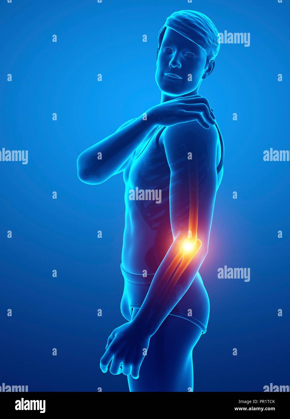 Man with elbow pain, computer illustration Stock Photo - Alamy