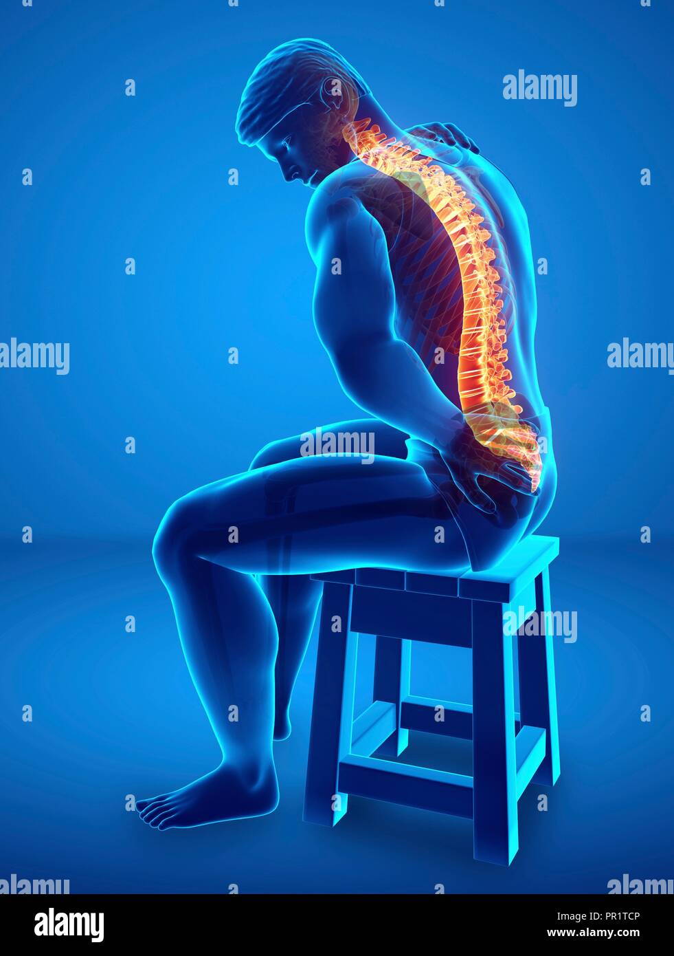 Man with back pain, computer illustration Stock Photo - Alamy