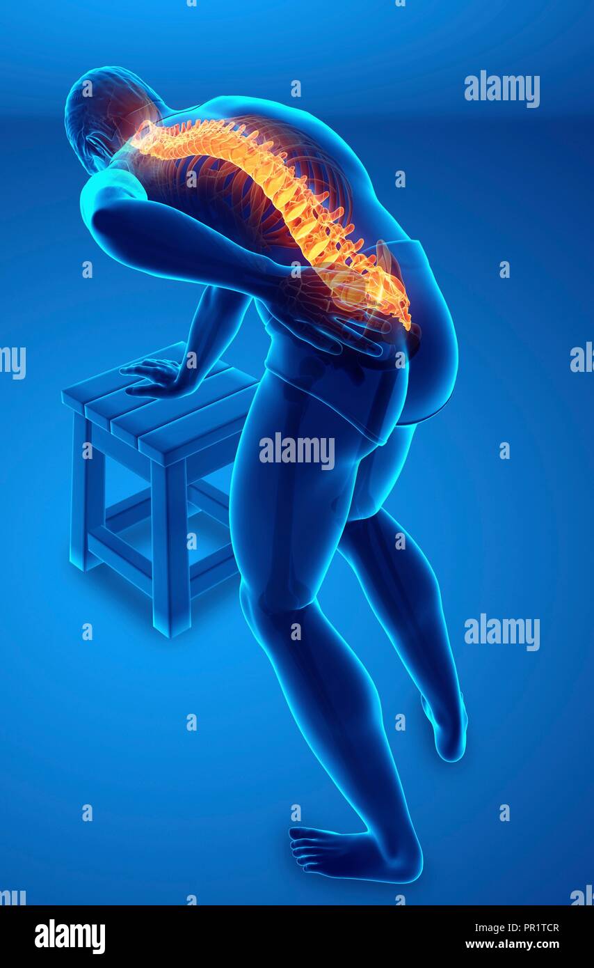 Man with back pain, computer illustration Stock Photo - Alamy
