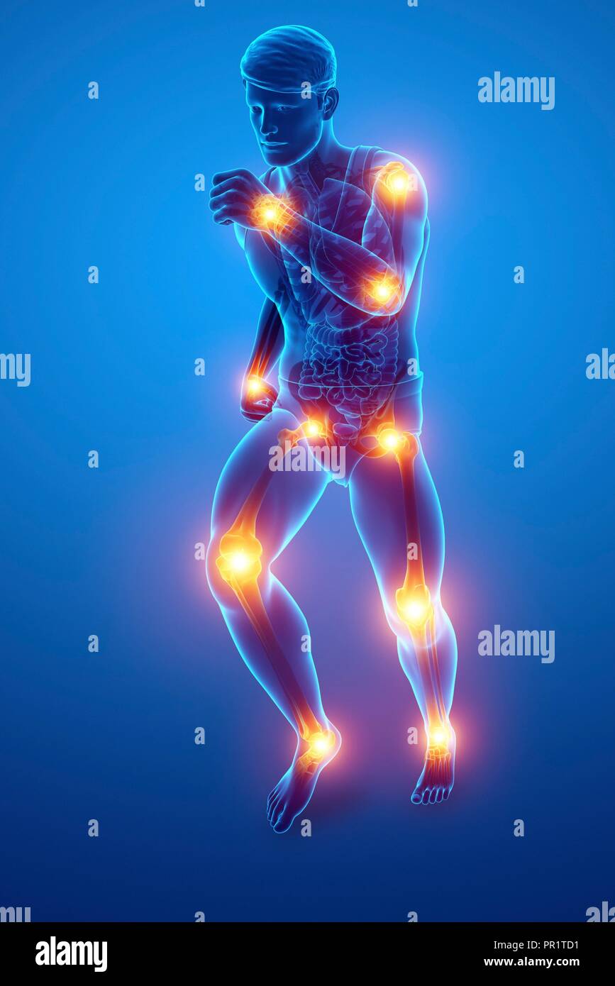 Man with joint pain, computer illustration Stock Photo - Alamy