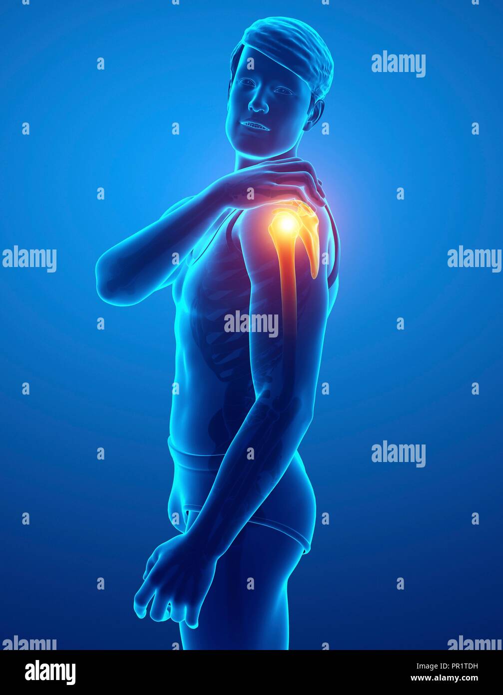 Man with shoulder pain, computer illustration Stock Photo - Alamy
