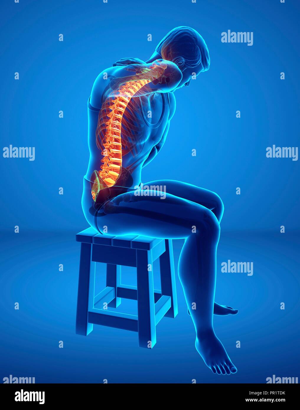 Man with back pain, computer illustration Stock Photo - Alamy