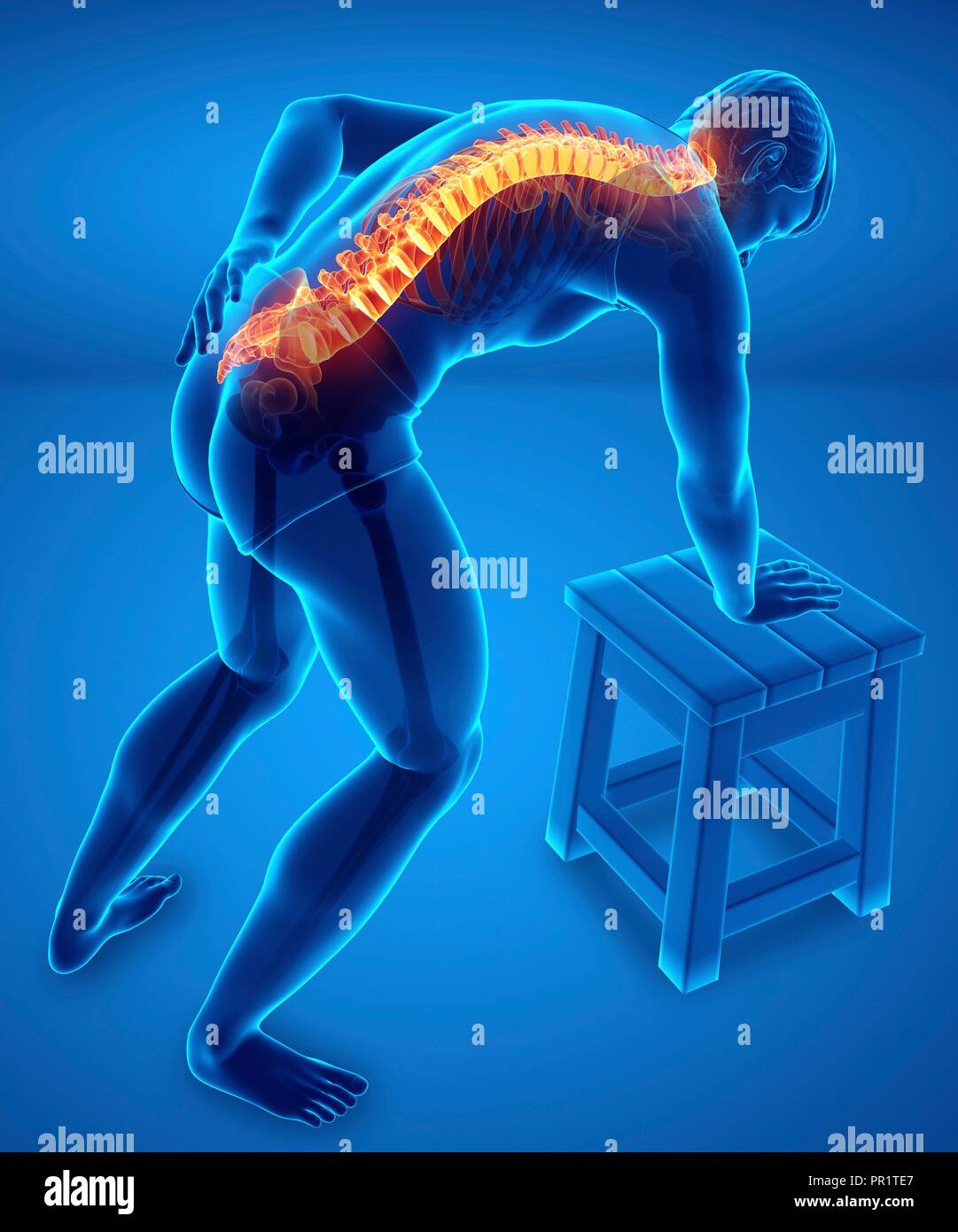 Man with back pain, computer illustration Stock Photo - Alamy
