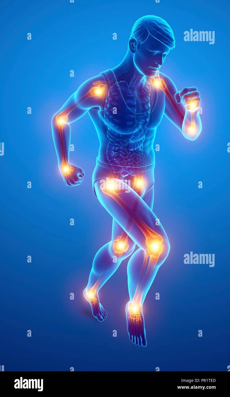 Man with joint pain, computer illustration Stock Photo - Alamy