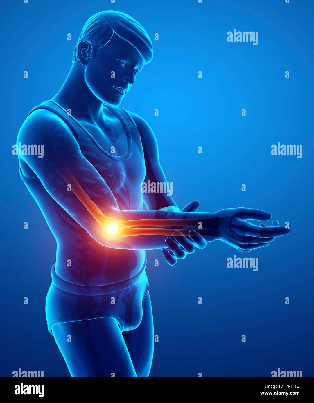 Man with elbow pain, computer illustration Stock Photo - Alamy