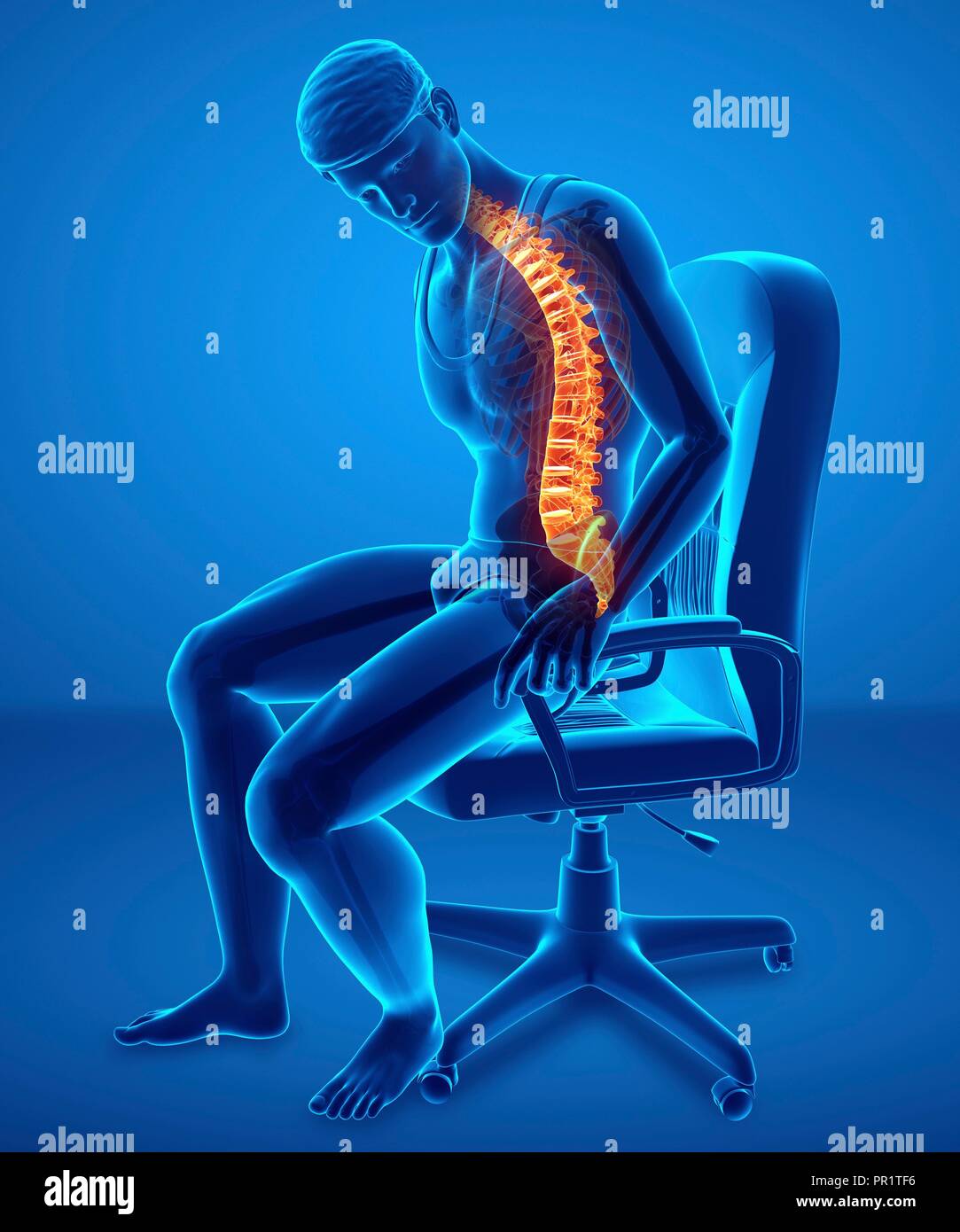 Man with back pain, computer illustration Stock Photo - Alamy