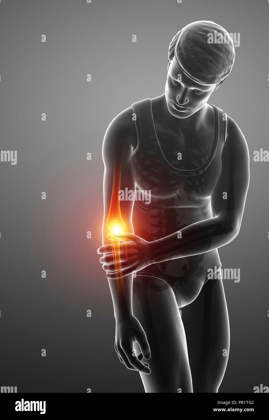 Elbow pain hi-res stock photography and images - Alamy