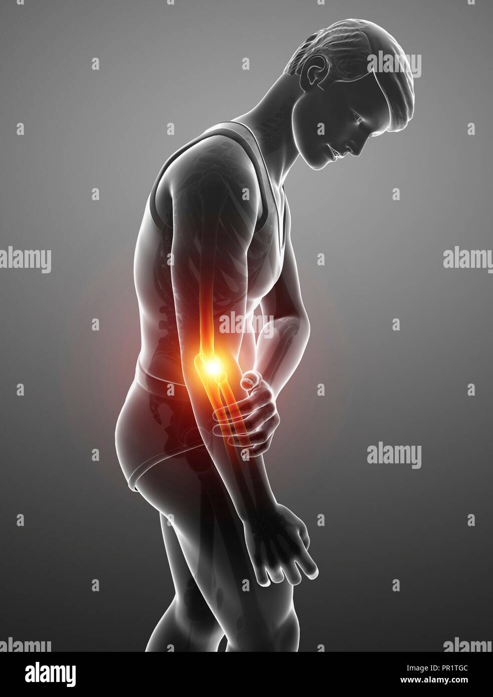 Man with elbow pain, computer illustration Stock Photo - Alamy
