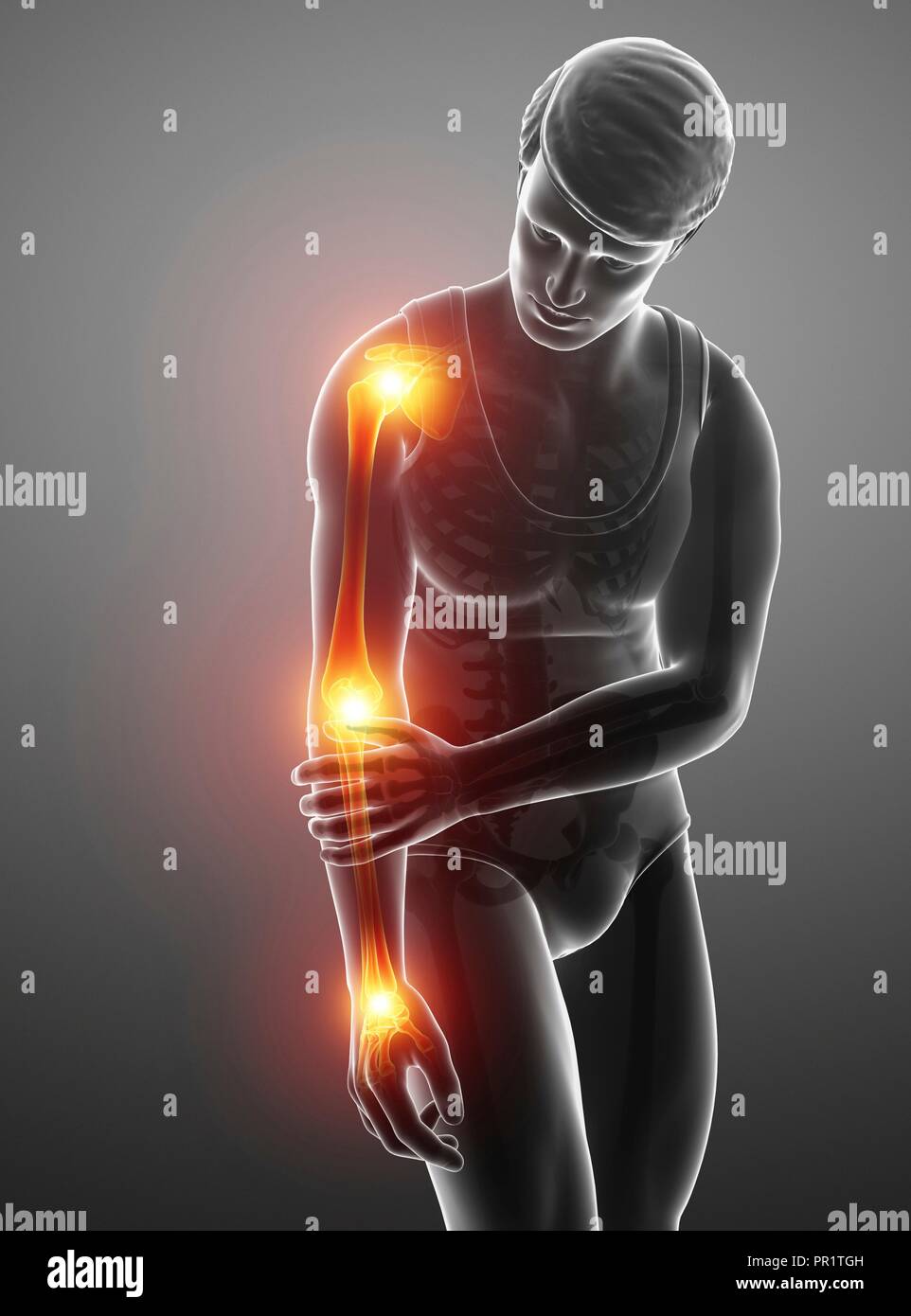 Man with arm pain, computer illustration Stock Photo - Alamy