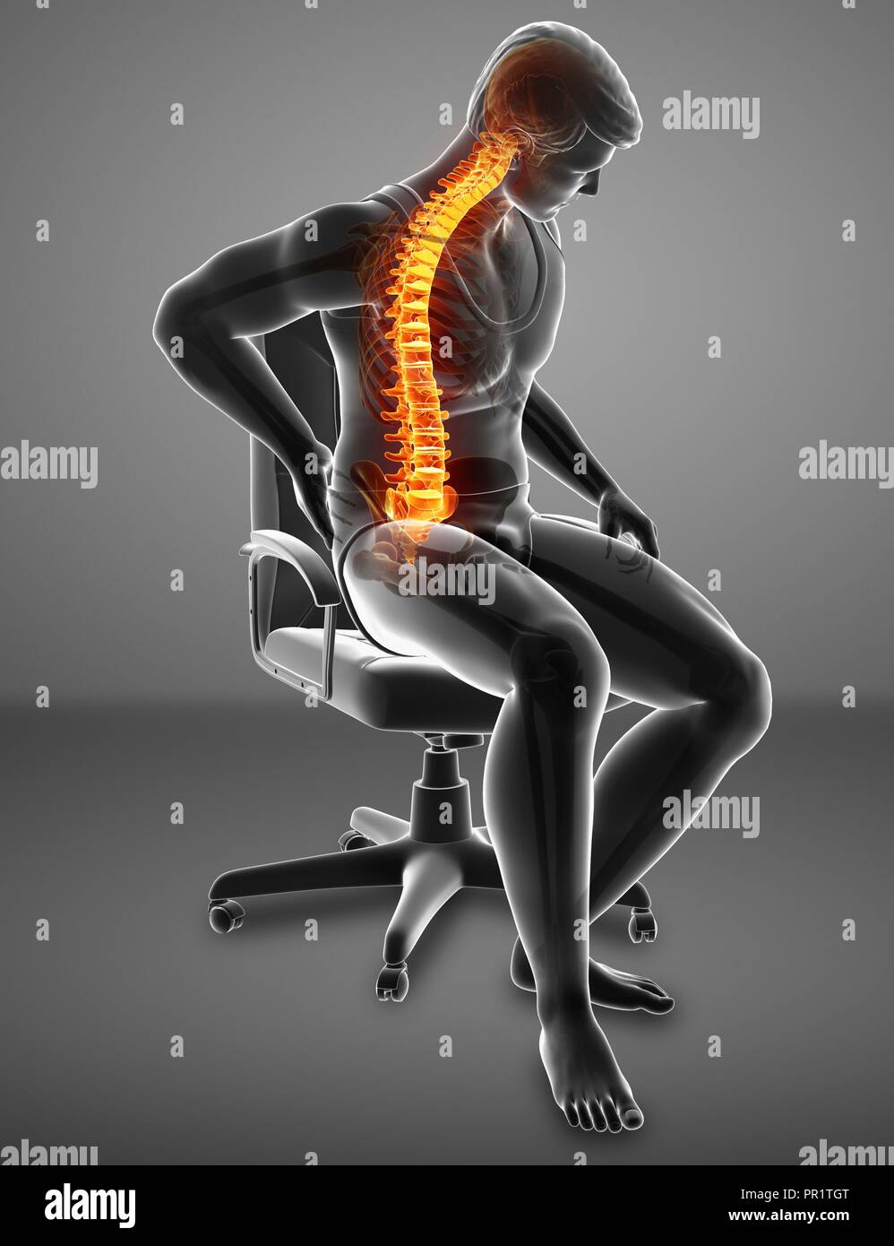 Man with back pain, computer illustration Stock Photo - Alamy