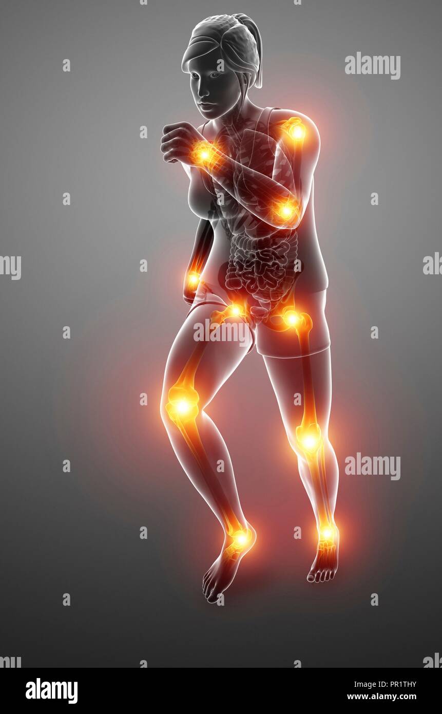 Woman with joint pain, computer illustration Stock Photo - Alamy