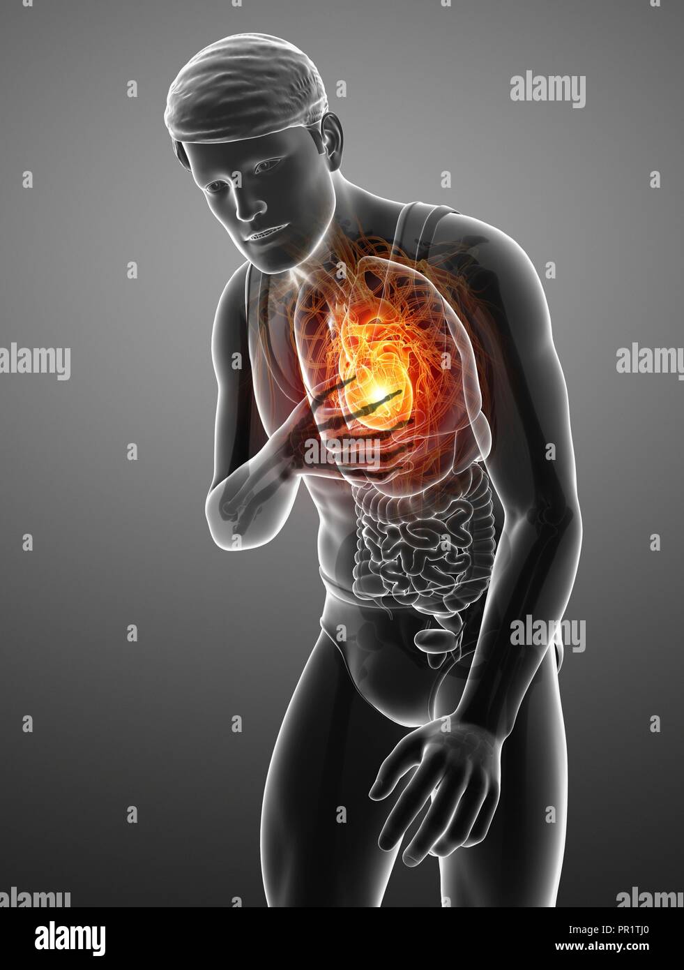 Man with chest pain, computer illustration Stock Photo - Alamy