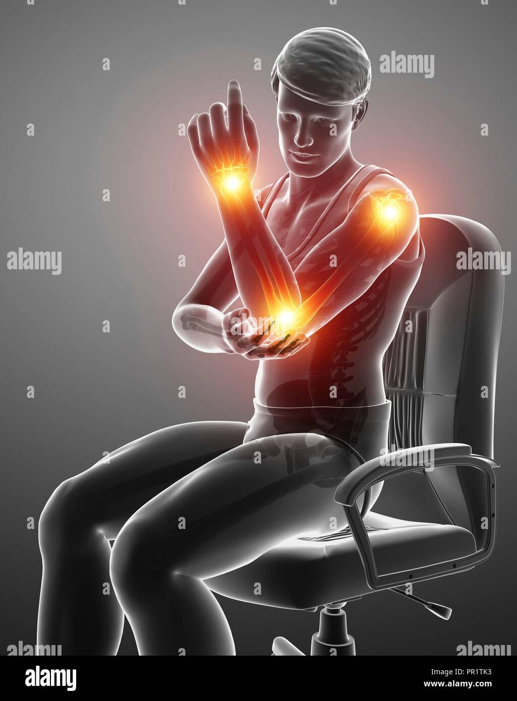 Man with arm pain, computer illustration Stock Photo - Alamy