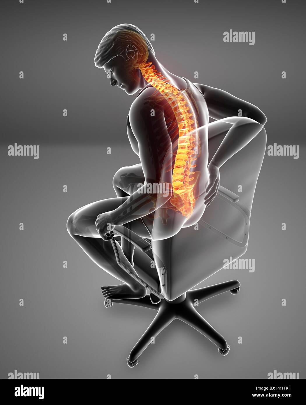 Man with back pain, computer illustration Stock Photo - Alamy