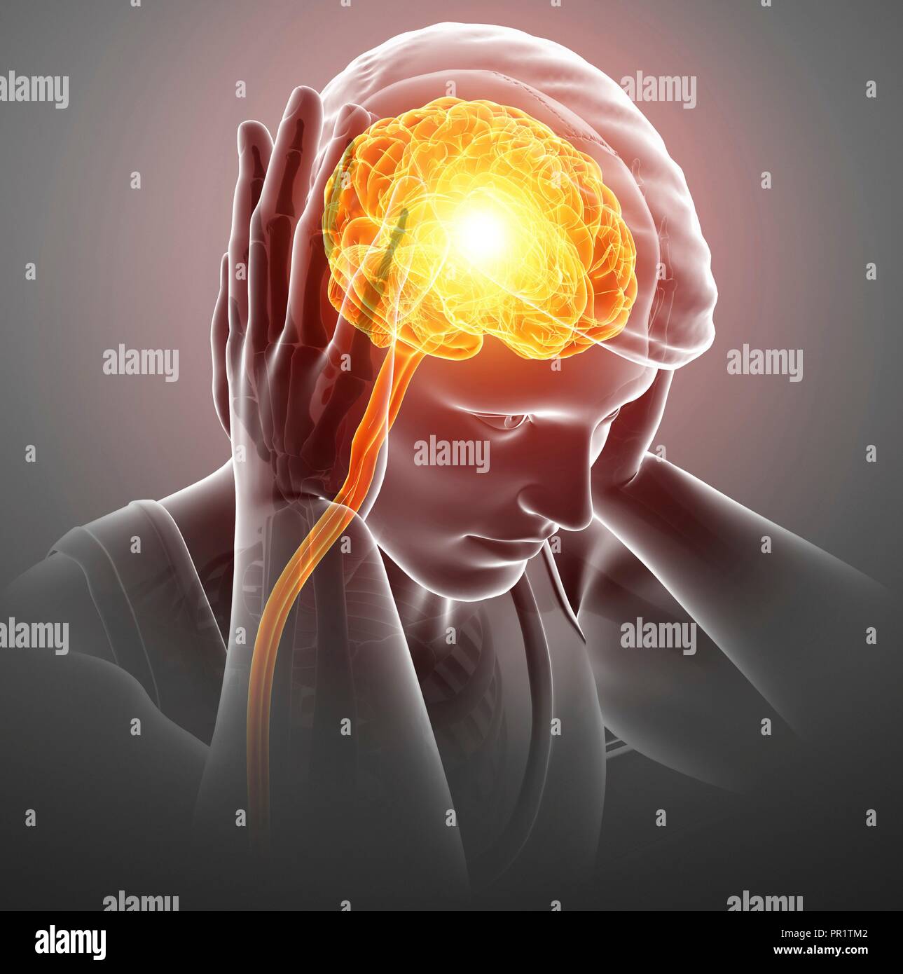Man with headache, computer illustration Stock Photo - Alamy