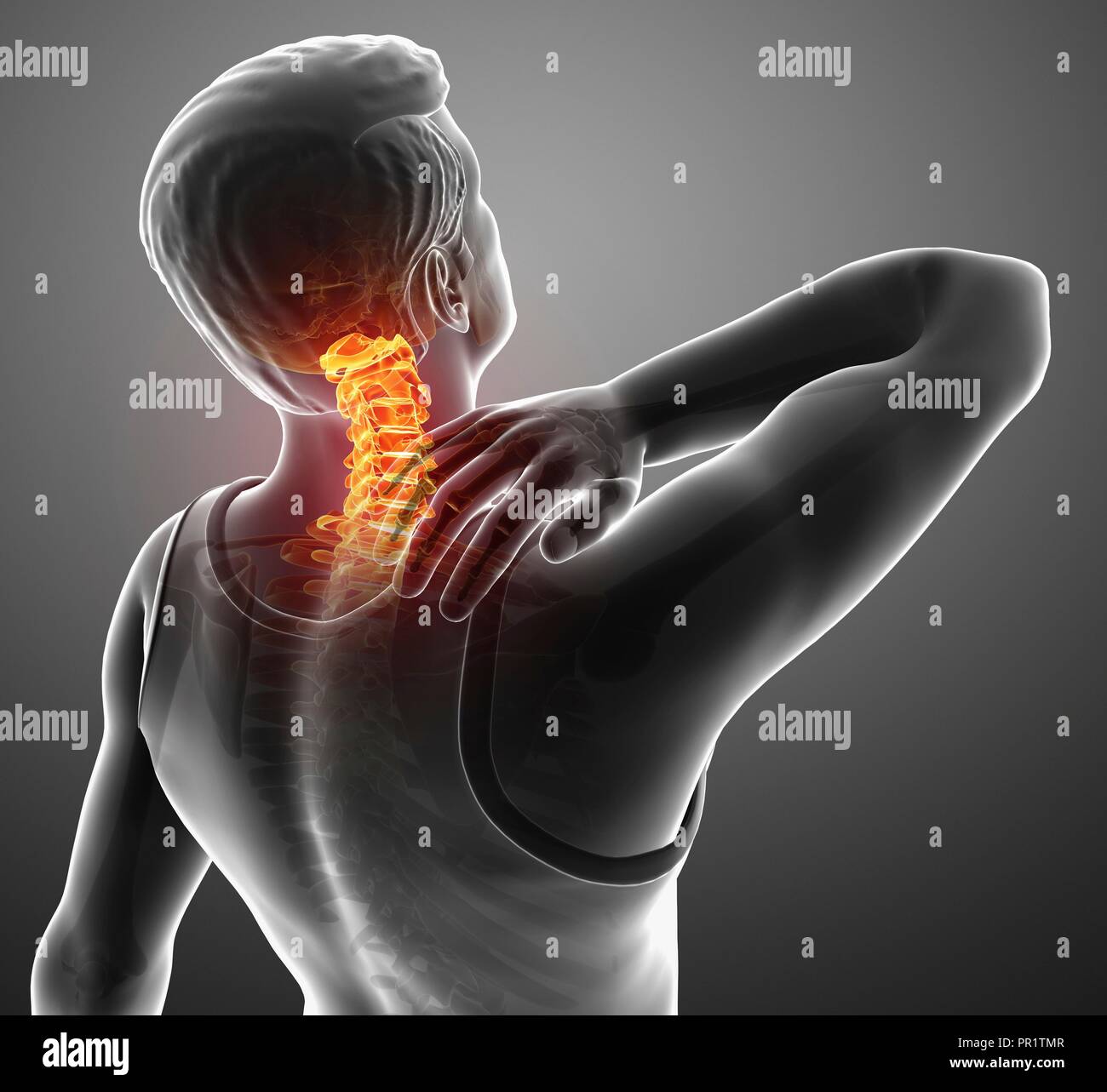 Man with back pain, computer illustration Stock Photo - Alamy