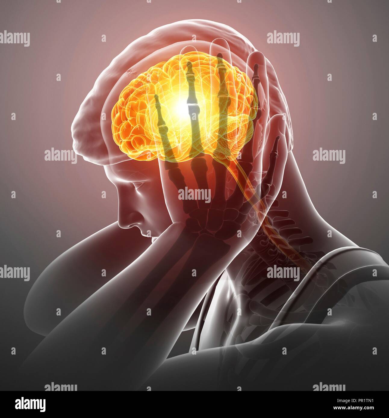 Man with headache, computer illustration Stock Photo - Alamy