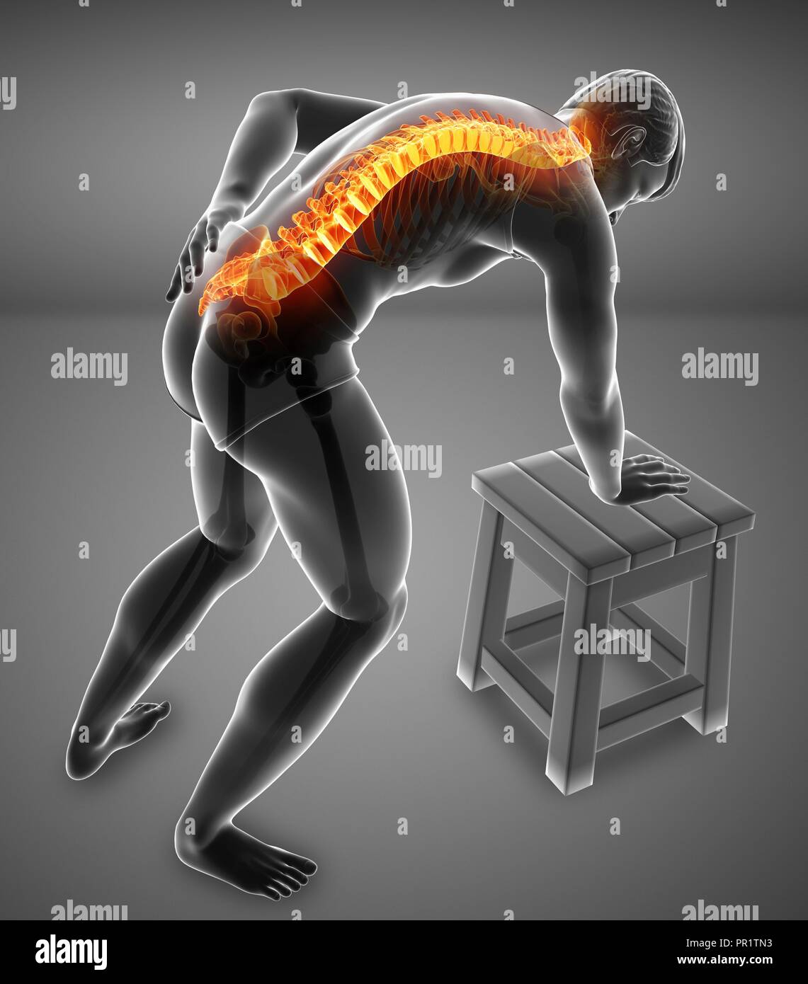 Man with back pain, computer illustration Stock Photo - Alamy