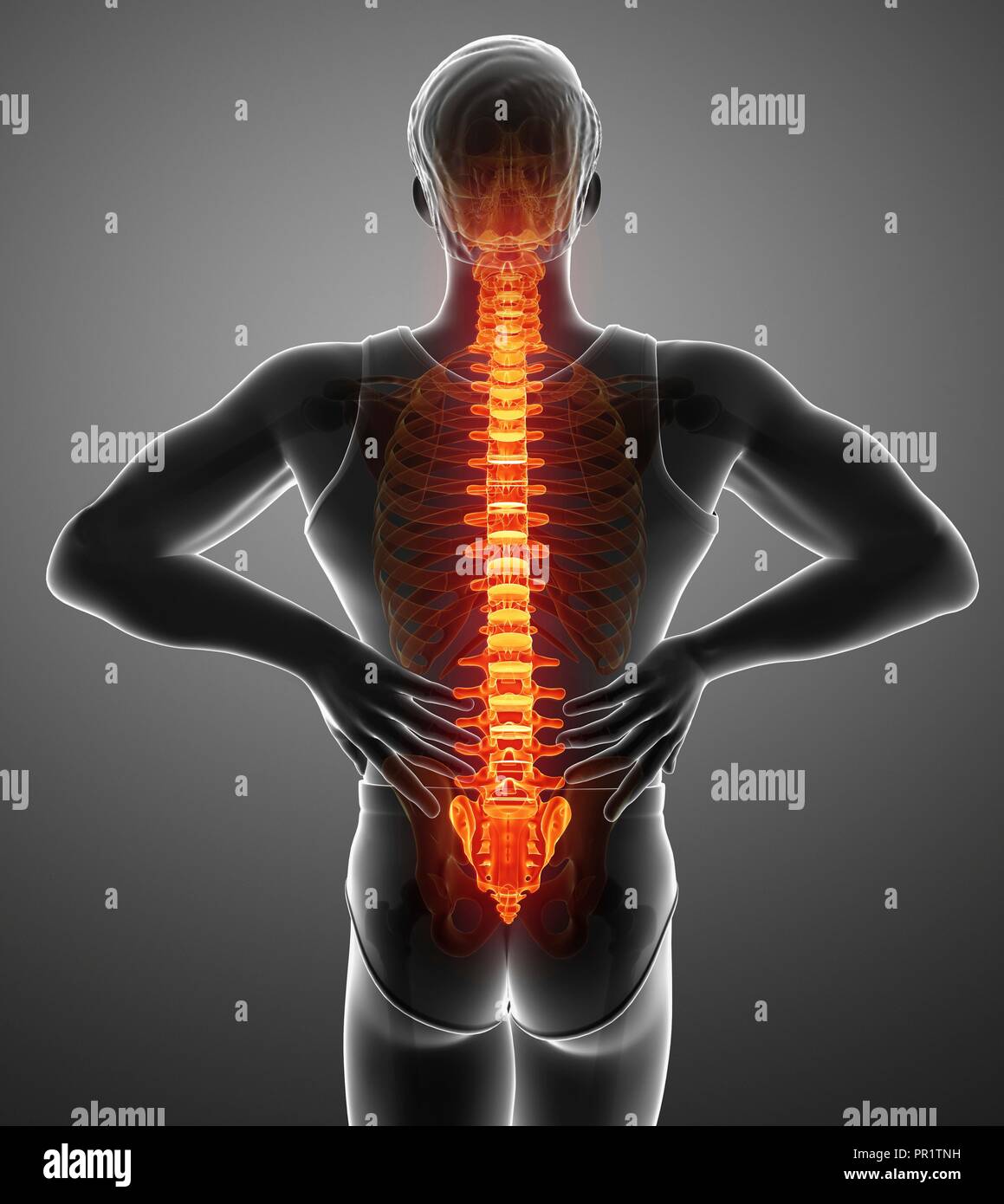 Man with back pain, computer illustration Stock Photo - Alamy